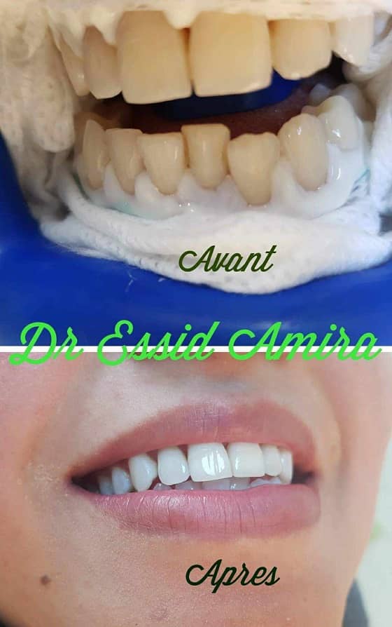Dentiste à Monastir | Cabinet dentaire Dr Amira Essid
