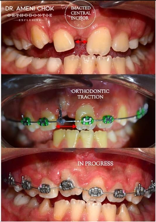 Orthodontiste à Sahloul | Dr Ameni Chok Boukadida